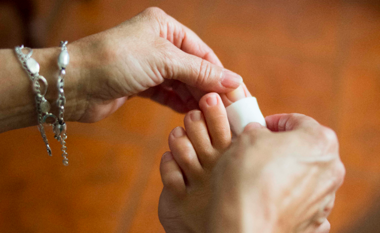 Pie diabético, ¿qué es y por qué se produce? - Blog de diabetes de ...